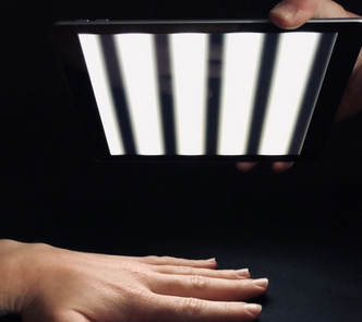 Skinscan - Low-cost 3d-scanning for dermatologic diagnosis and ...